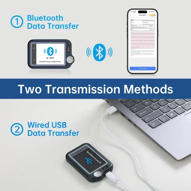 1-Lead ECG/EKG Heart Monitor, Portable AI Analysis, Touchscreen ...