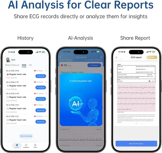 1-Lead ECG/EKG Heart Monitor, Portable AI Analysis, Touchscreen ...